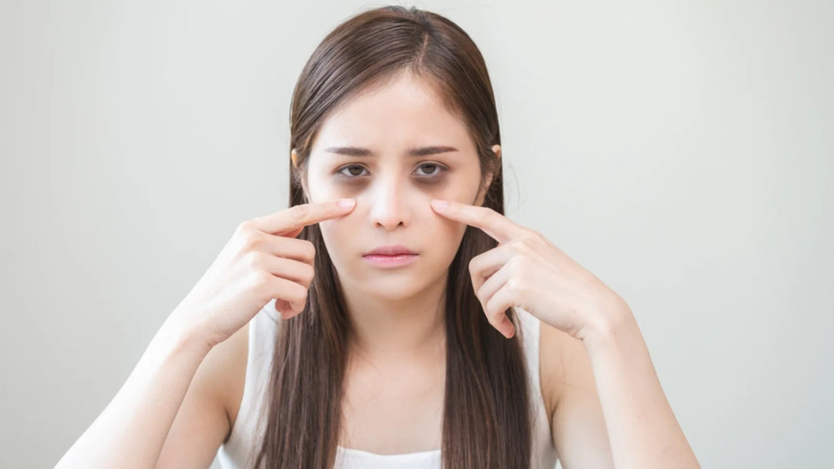 Les Cernes sous les Yeux : Causes et Solutions Efficaces ! – PURNATUREL